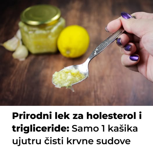 Prirodni lek za holesterol i trigliceride: Detaljan vodič
